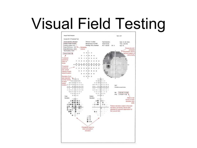 Clinical approach to acute vision loss | PPTX