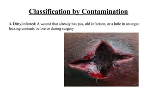 clinical approach to wounds - .ppt The Basics | PPTX