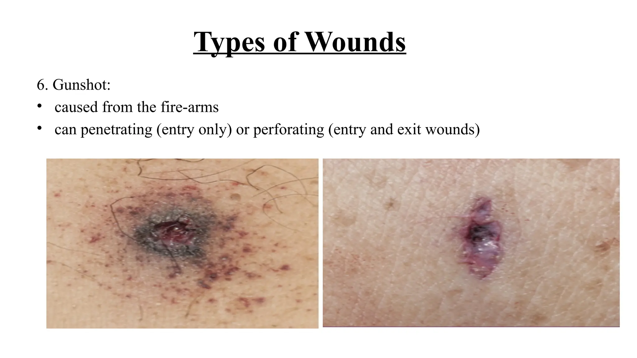clinical approach to wounds - .pptx The Basics | PPTX