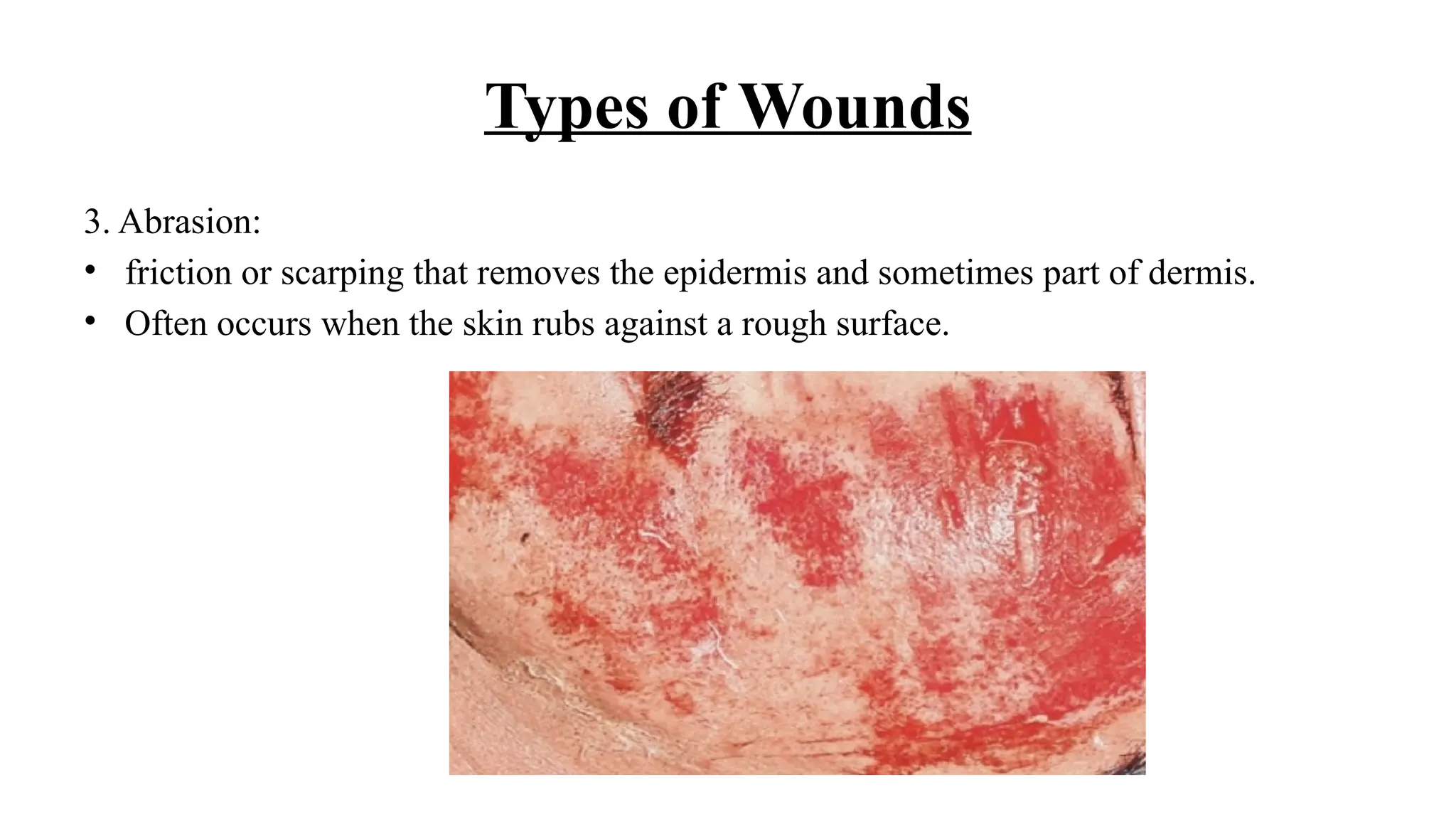 clinical approach to wounds - .pptx The Basics | PPTX