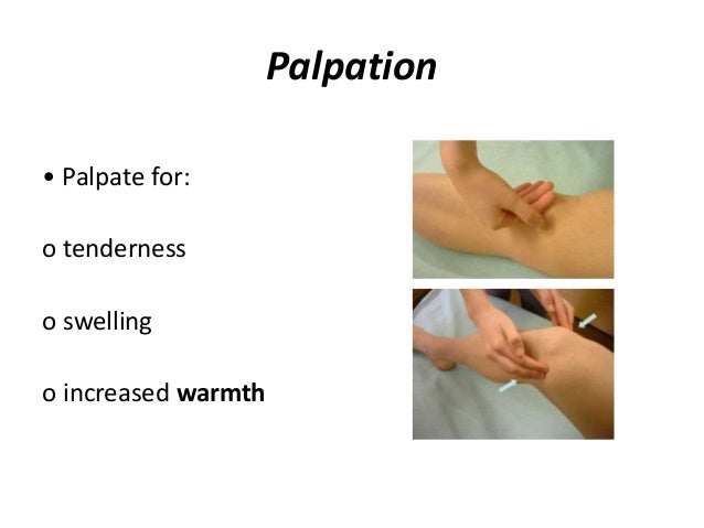 Clinical approch to rheumatological examination