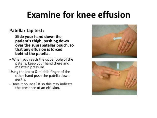 Clinical approch to rheumatological examination