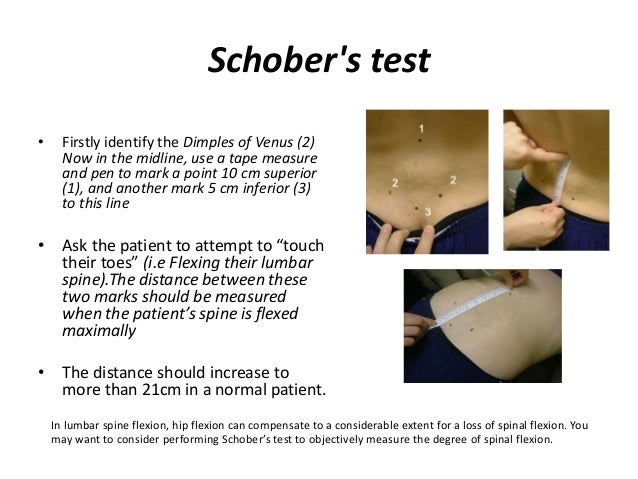 Clinical approch to rheumatological examination