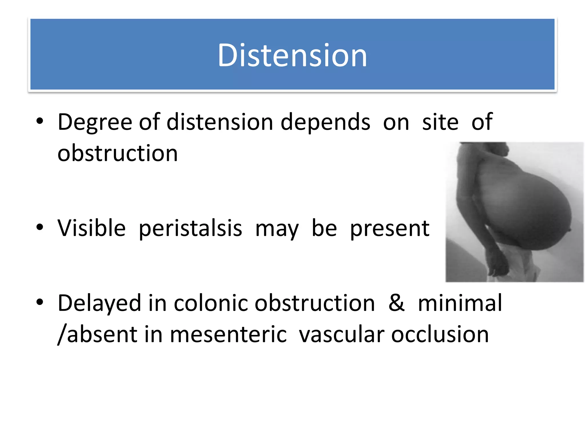 Clinical aspect of intestinal obstruction Ritasman Baisya Medical ...