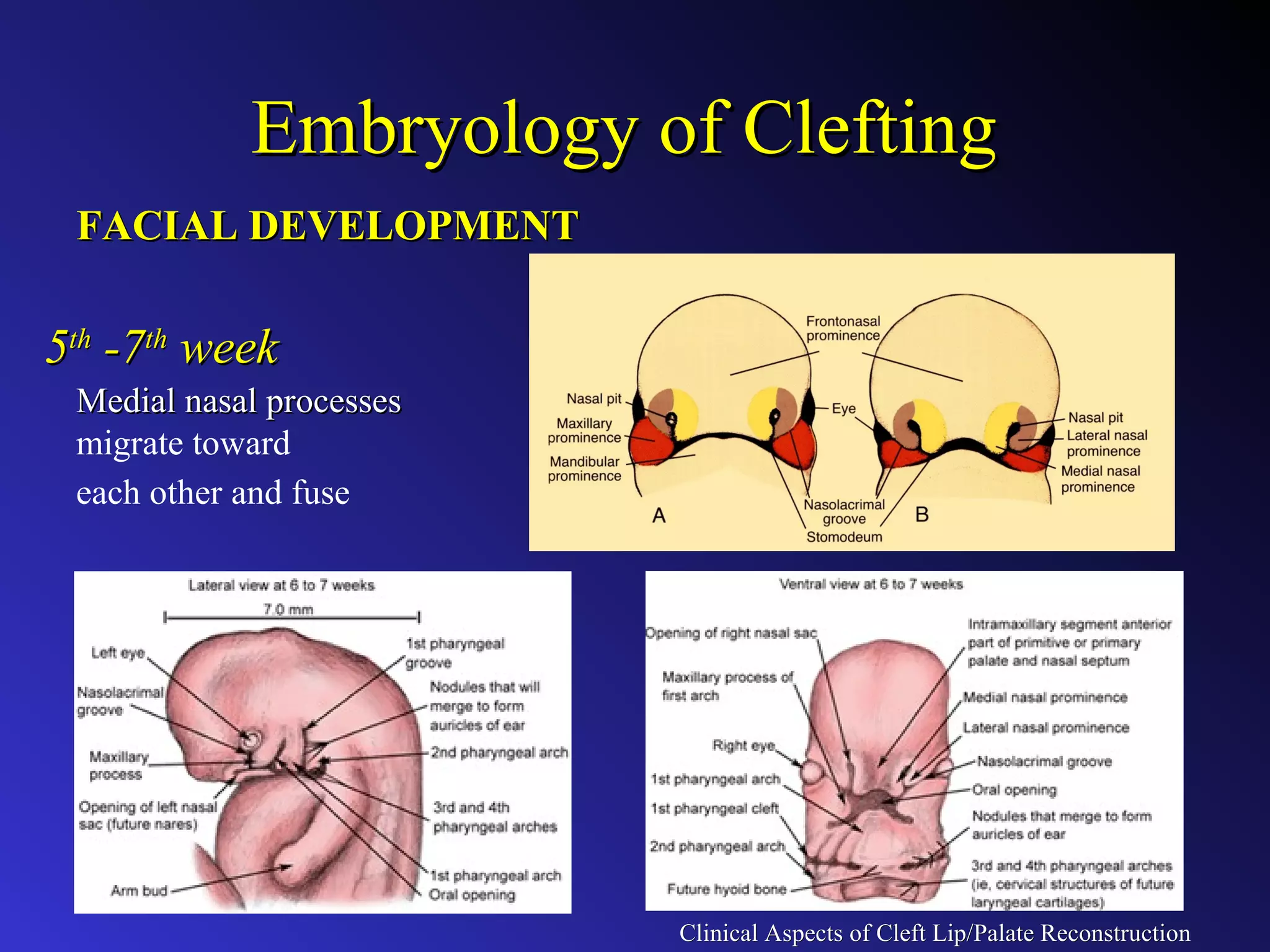 Clinical aspects of cleft lip & palate reconstruction | PPT