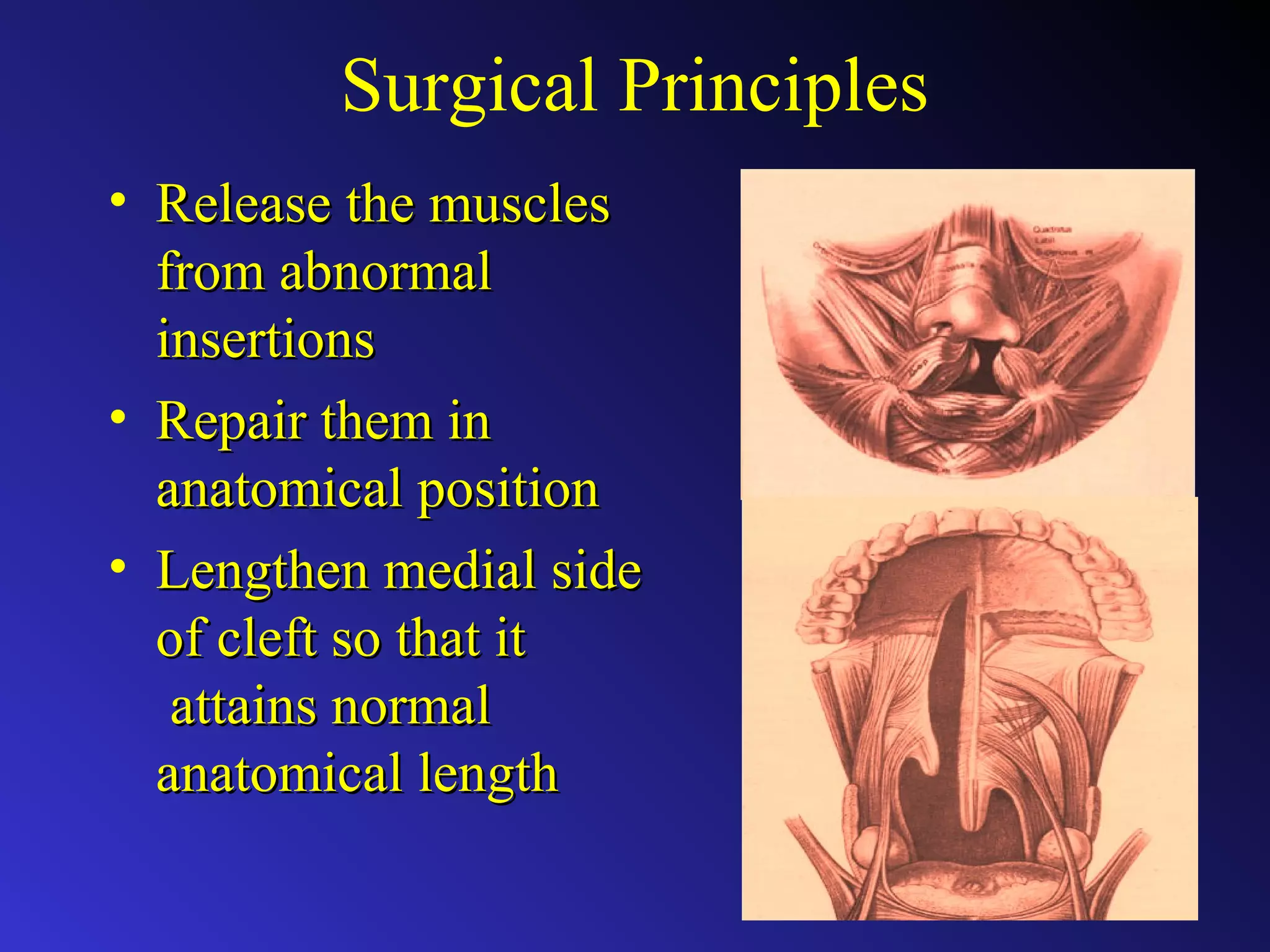 Clinical aspects of cleft lip & palate reconstruction | PPT