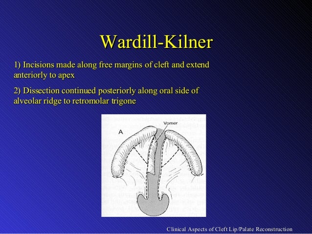 Clinical aspects of cleft lip & palate reconstruction