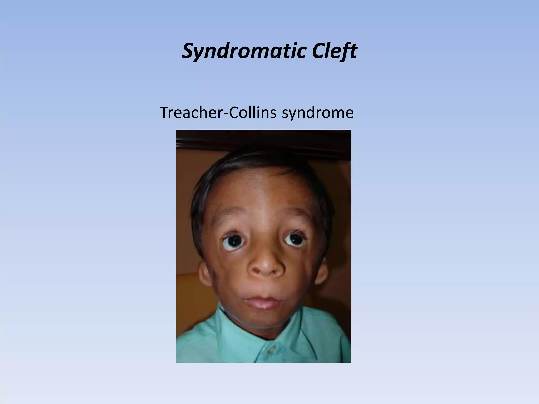 Clinical aspects of cleft palate repair | PPTX