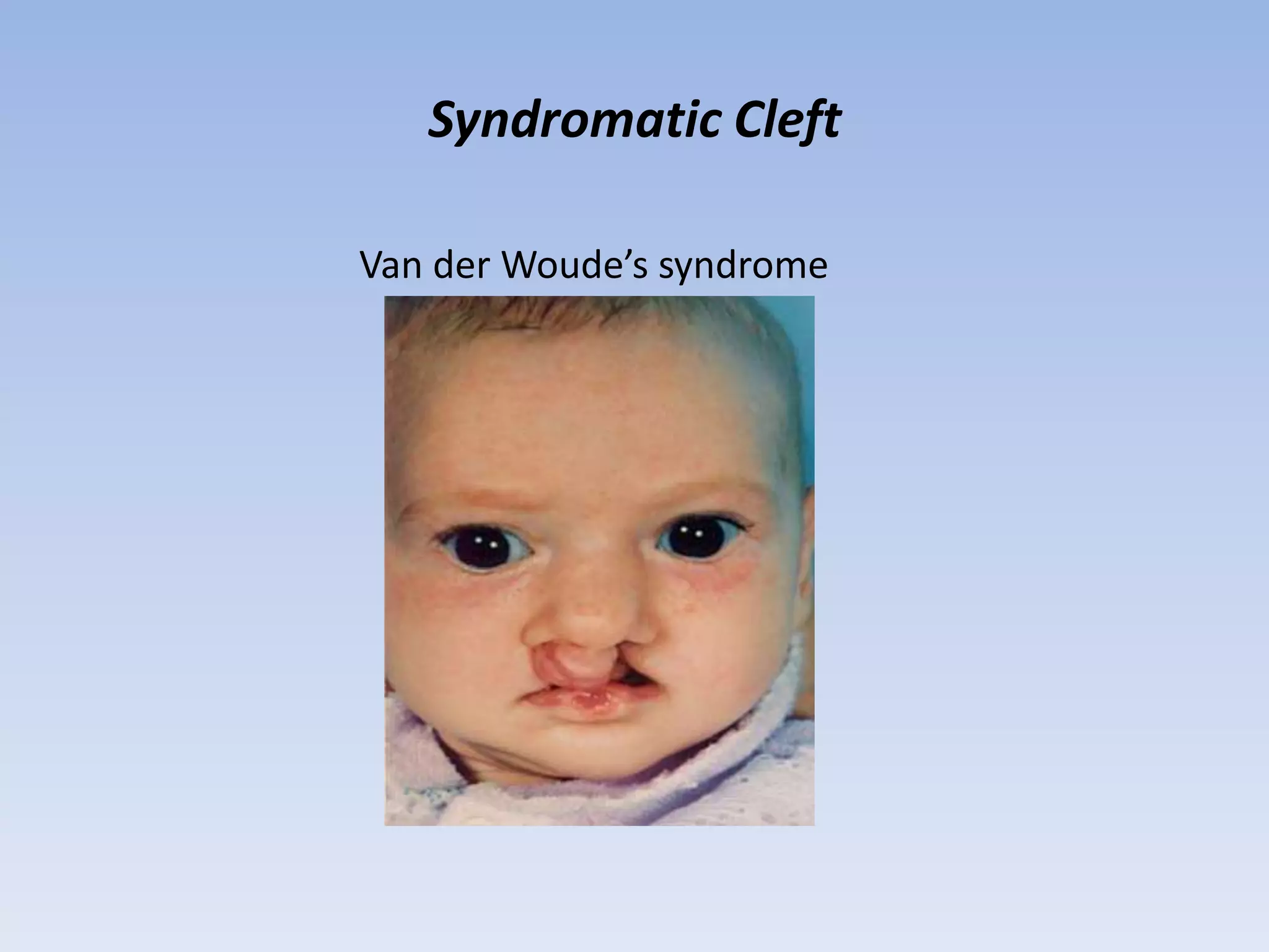 Clinical aspects of cleft palate repair | PPTX