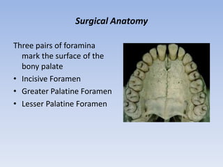 Clinical aspects of cleft palate repair | PPTX