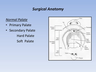 Clinical aspects of cleft palate repair | PPTX