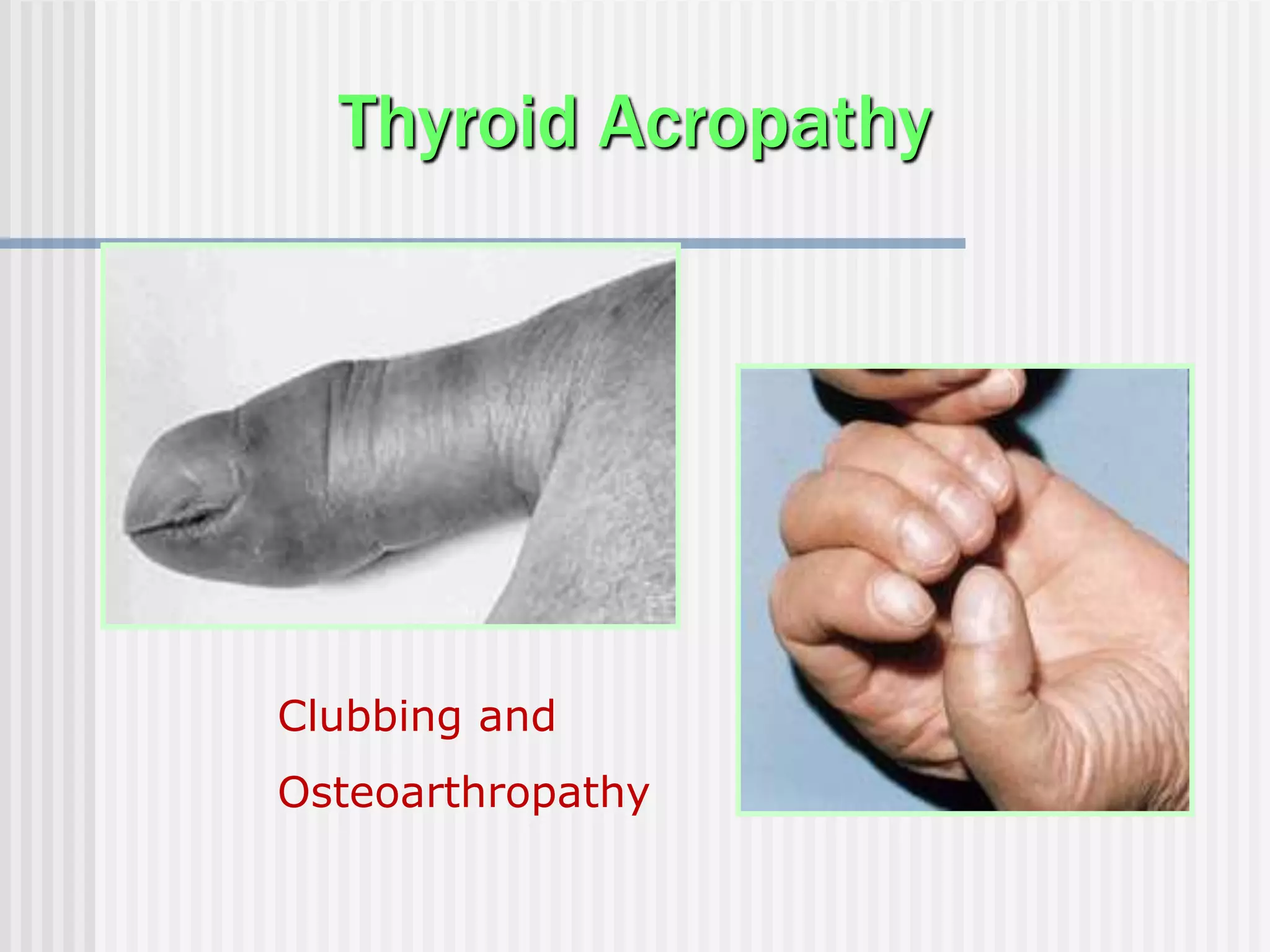 Clinical aspects of thyroid disorders (2015) | PPTX
