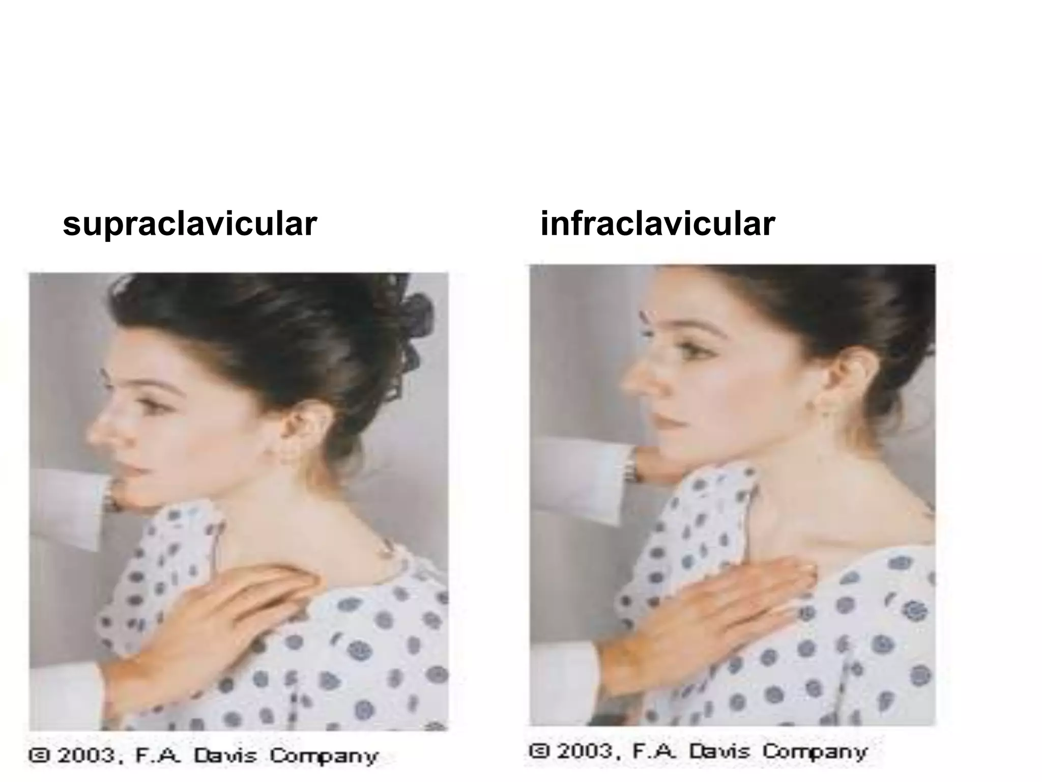 Clinical assessment of breast | PPTX