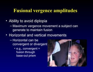 Clinical Assessment of Strabismus and evaluation technique | PPT