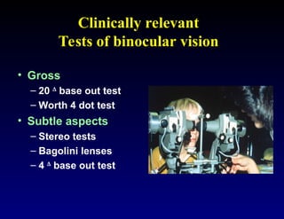 Clinical Assessment of Strabismus and evaluation technique | PPT