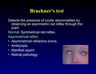 Clinical Assessment of Strabismus and evaluation technique | PPT