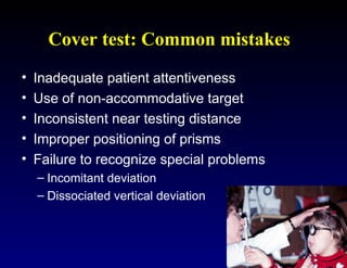 Clinical Assessment of Strabismus and evaluation technique | PPT