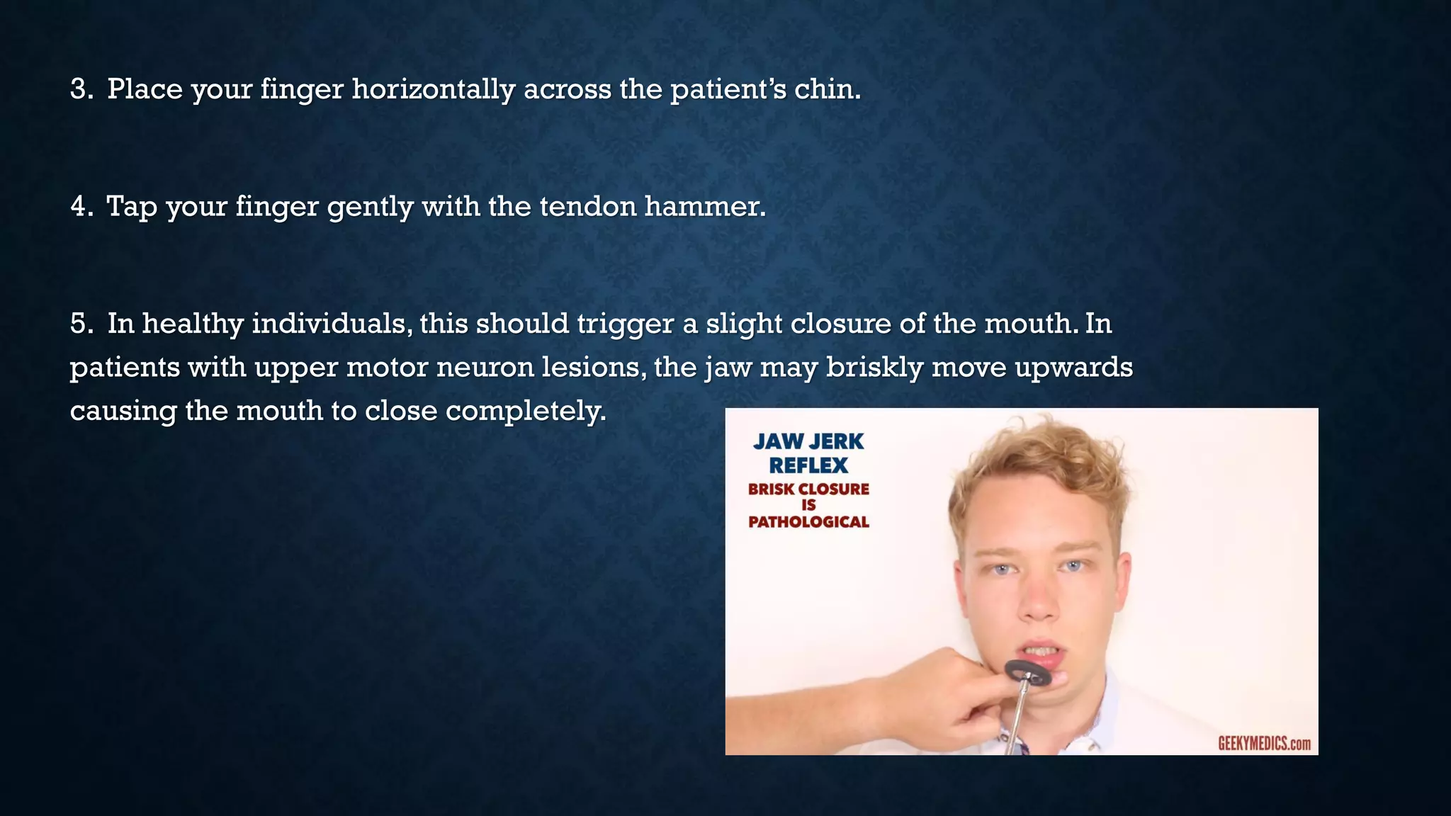 Clinical assessment of trigeminal nerve.pdf