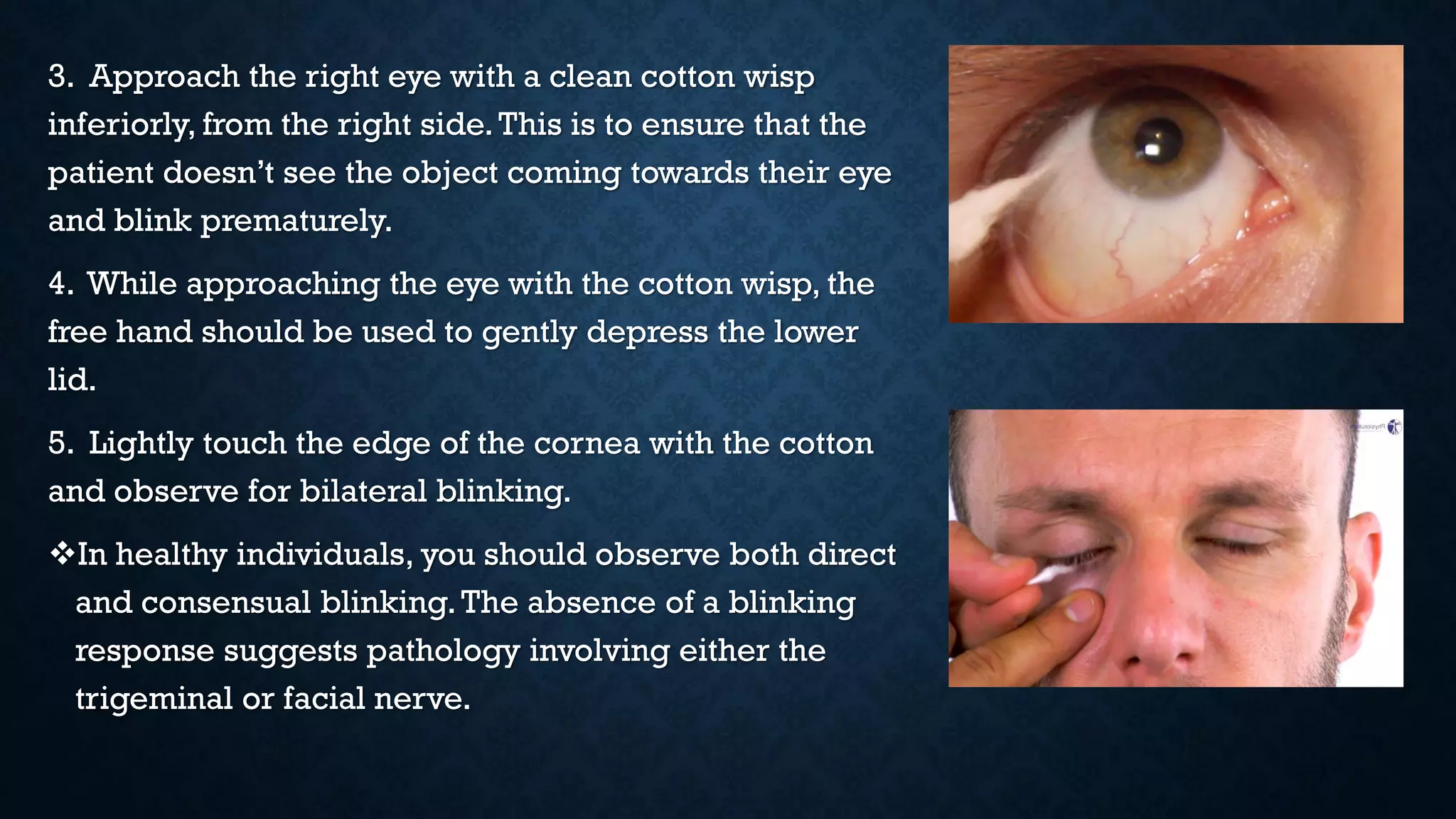 Clinical assessment of trigeminal nerve.pdf