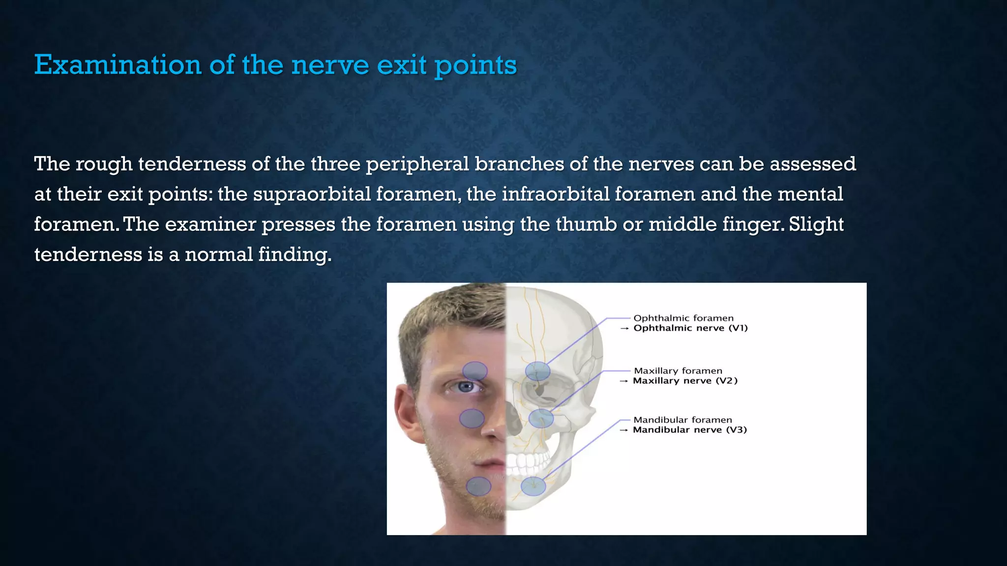 Clinical assessment of trigeminal nerve.pdf