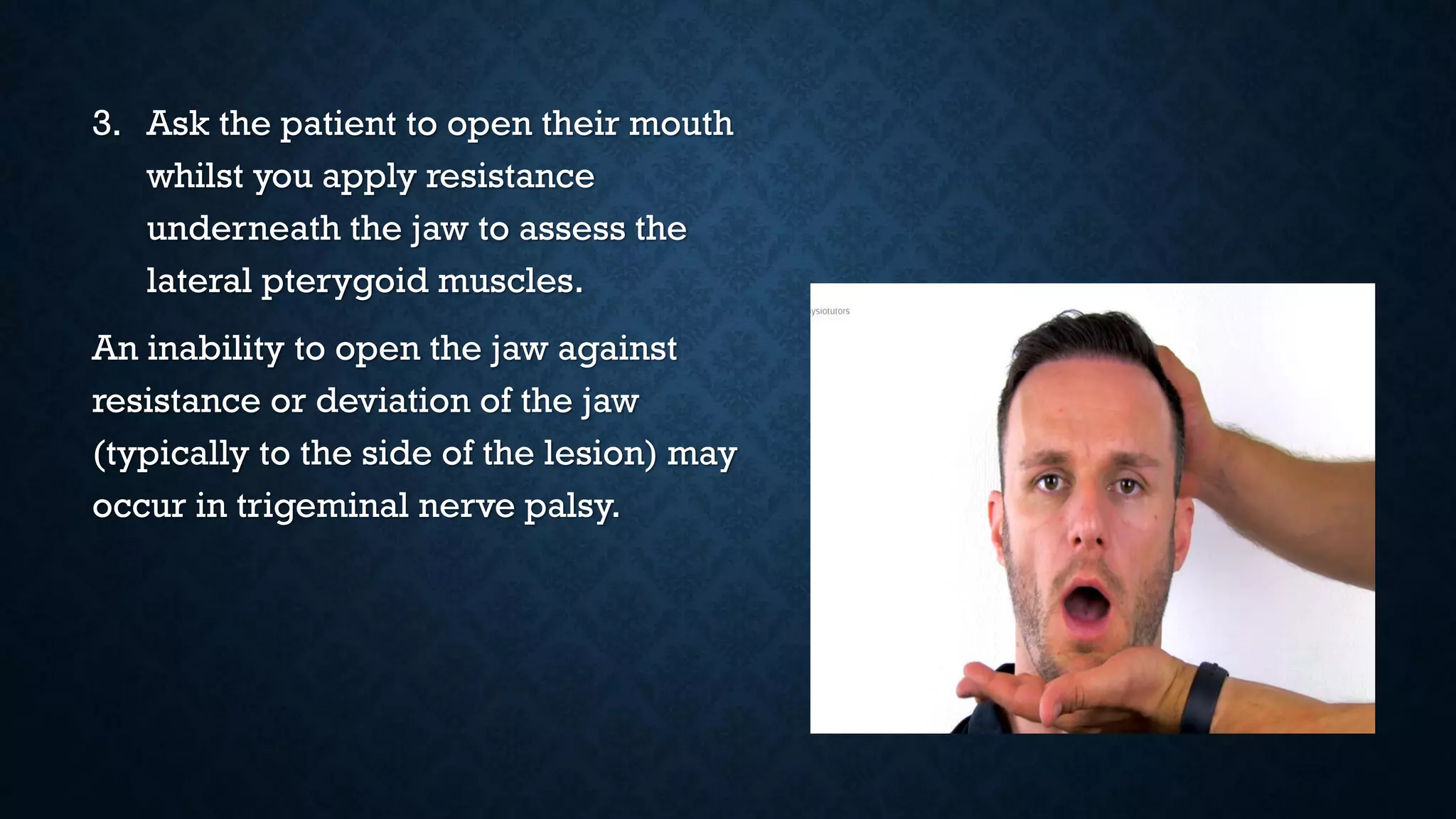 Clinical assessment of trigeminal nerve.pdf