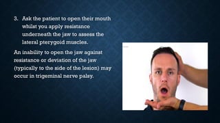 Clinical assessment of trigeminal nerve.pdf