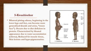 Clinical Biochemistry in pediatrics | PPTX