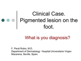 Clinical case. pigmented lesion on the toe | PPT
