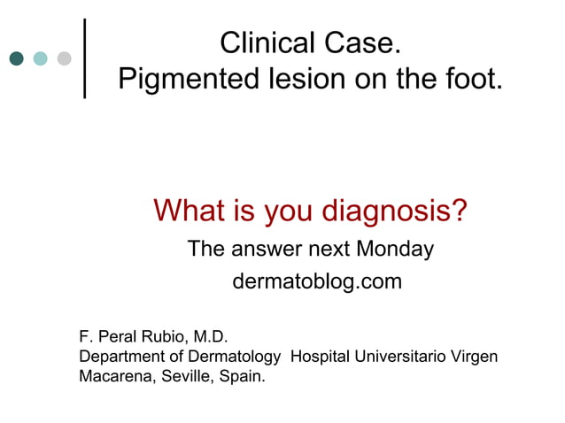 Clinical case. pigmented lesion on the toe | PPT