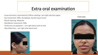 CLINICAL CASE PRESENTATION lateral wall orbit.pptx