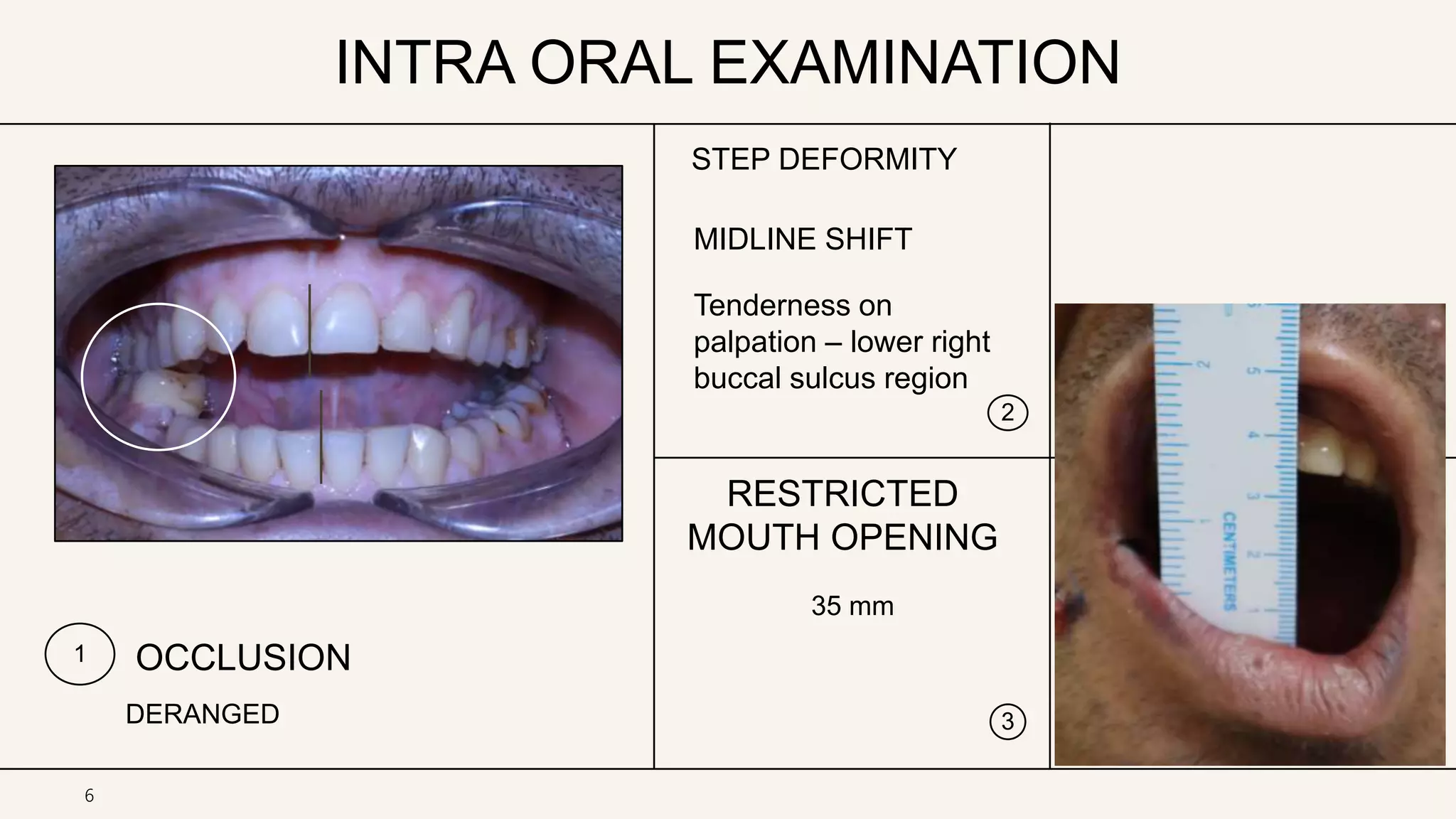CLINICAL CASE PRESENTATION in maxillofacial surgery.pptx
