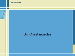 Clinical Case Body Building | PPT