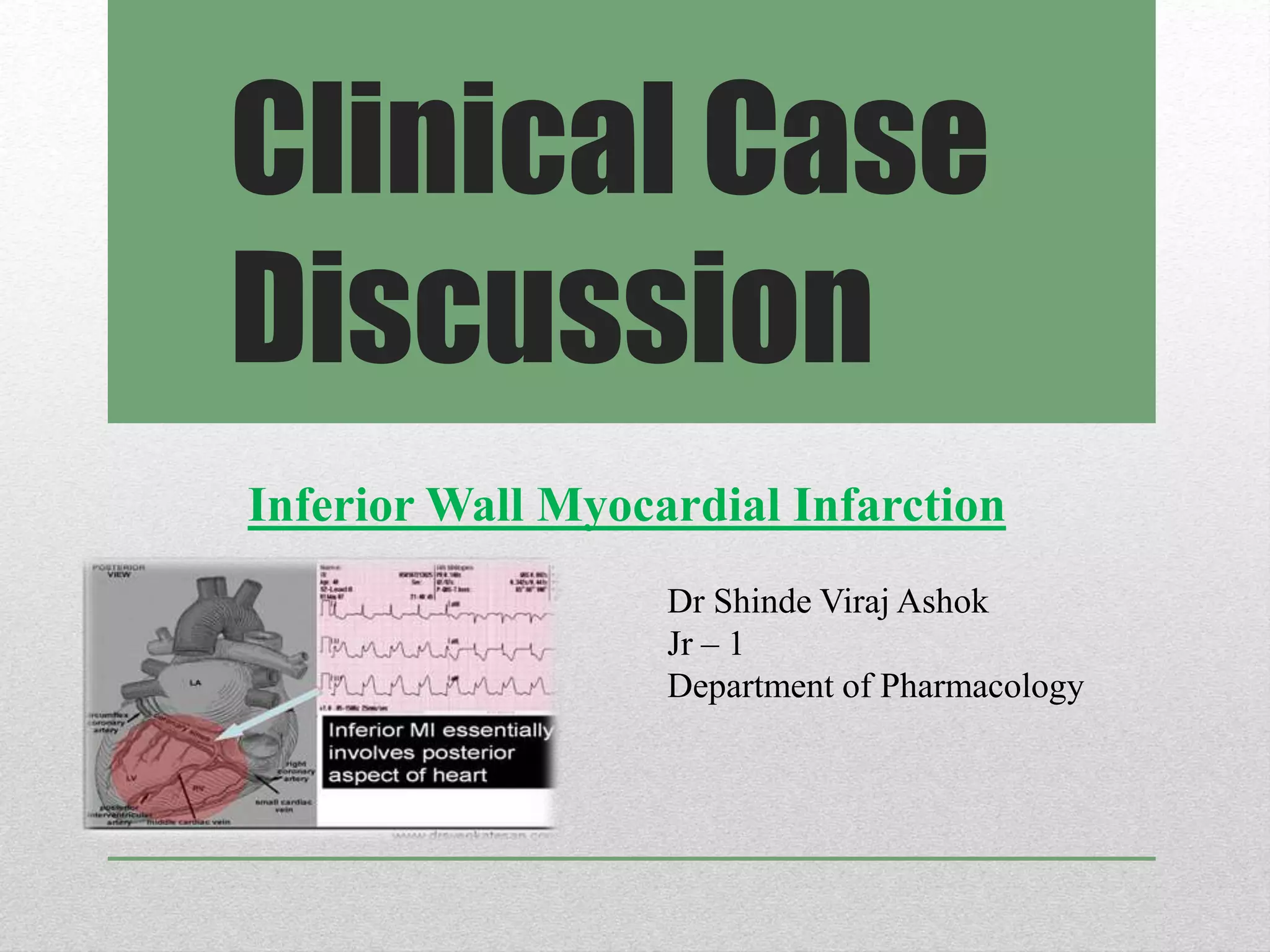 Clinical case discussion- inferior wall MI | PPTX