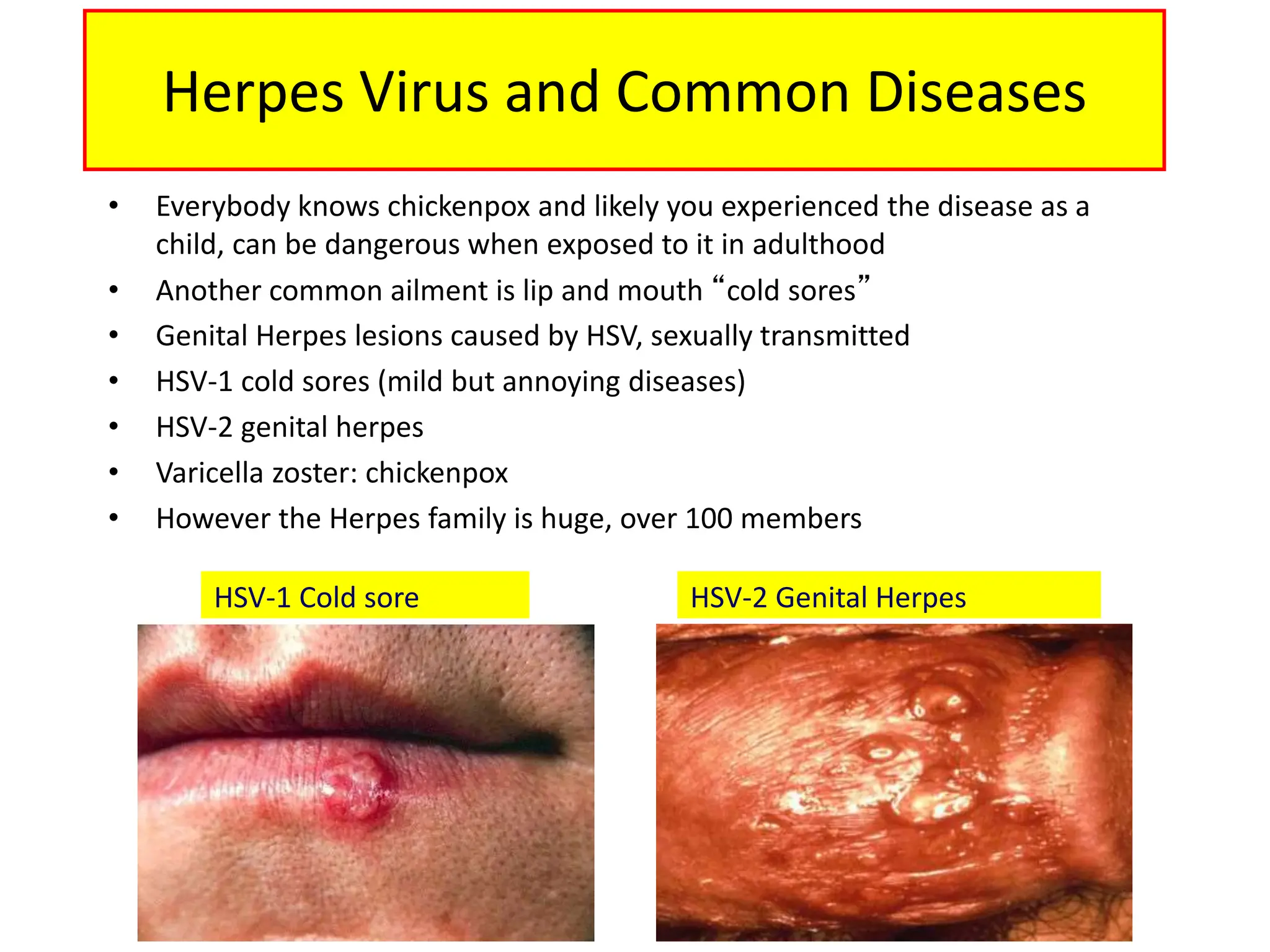 clinical case hepatitis b virus and herpes simplex virus.pptx
