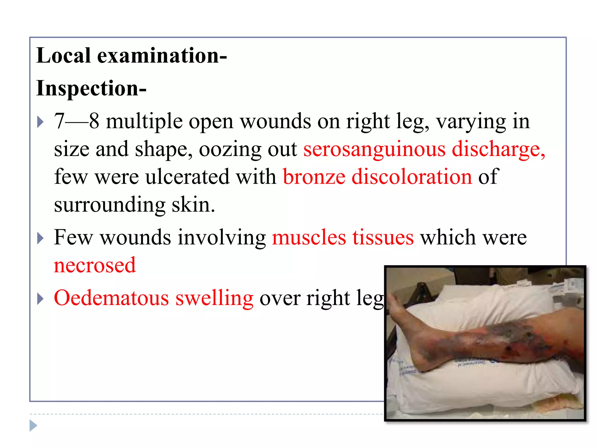 Clinical case presentation. gas gangrene | PPTX