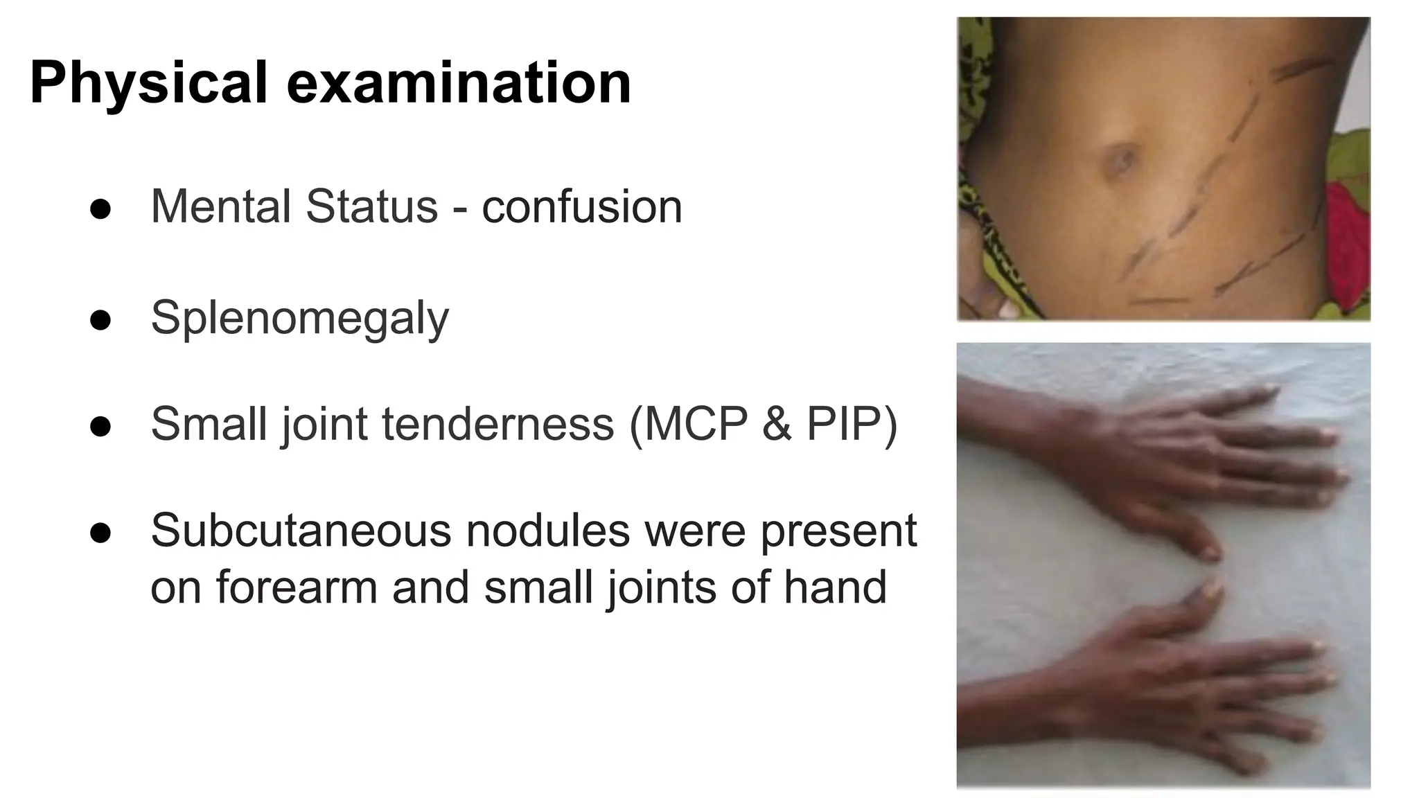 Clinical Case presentation.pdf about case discussion | PDF