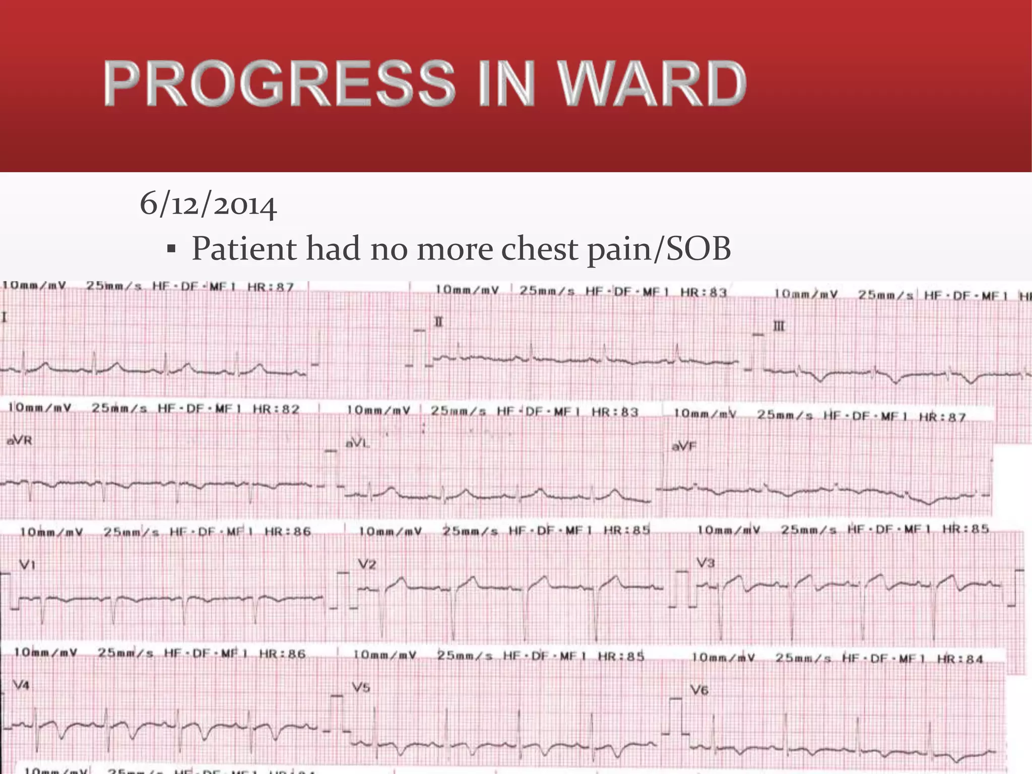 CLINICAL CASE PRESENTATION - STEMI.pptx