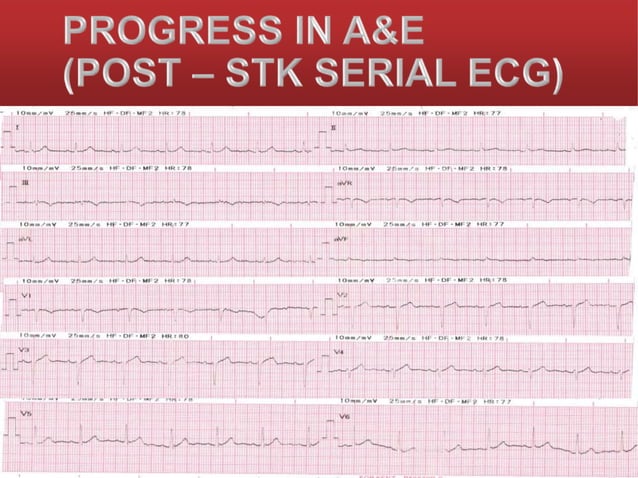 CLINICAL CASE PRESENTATION - STEMI.pptx