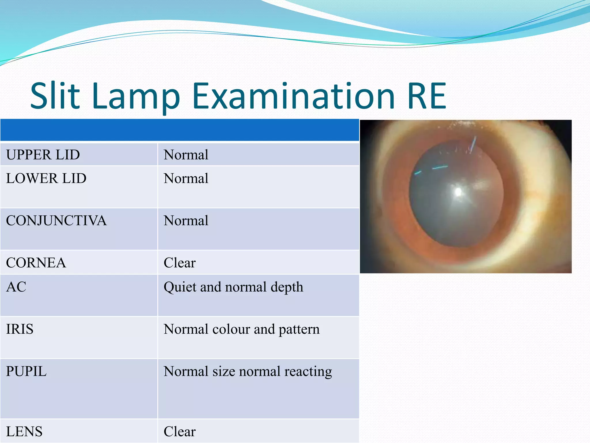 Ocular Neurocysticercosis | PPTX