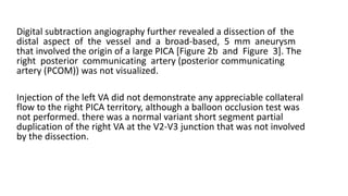 Clinical characteristics of symptomatic vertebral artery dissection | PPT