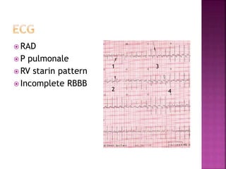 Pulmonary arterial hypertension | PPTX