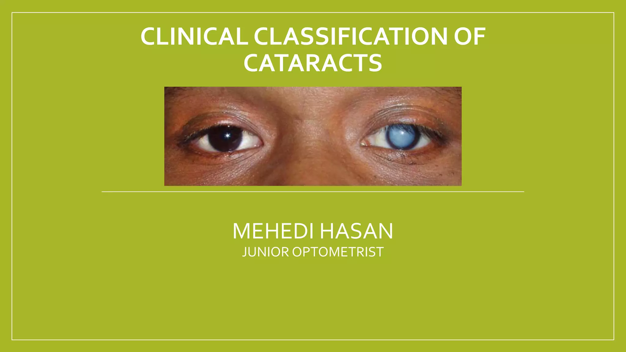 Clinical classification of cataracts : Mehedi , Jr. Optometrist | PPTX