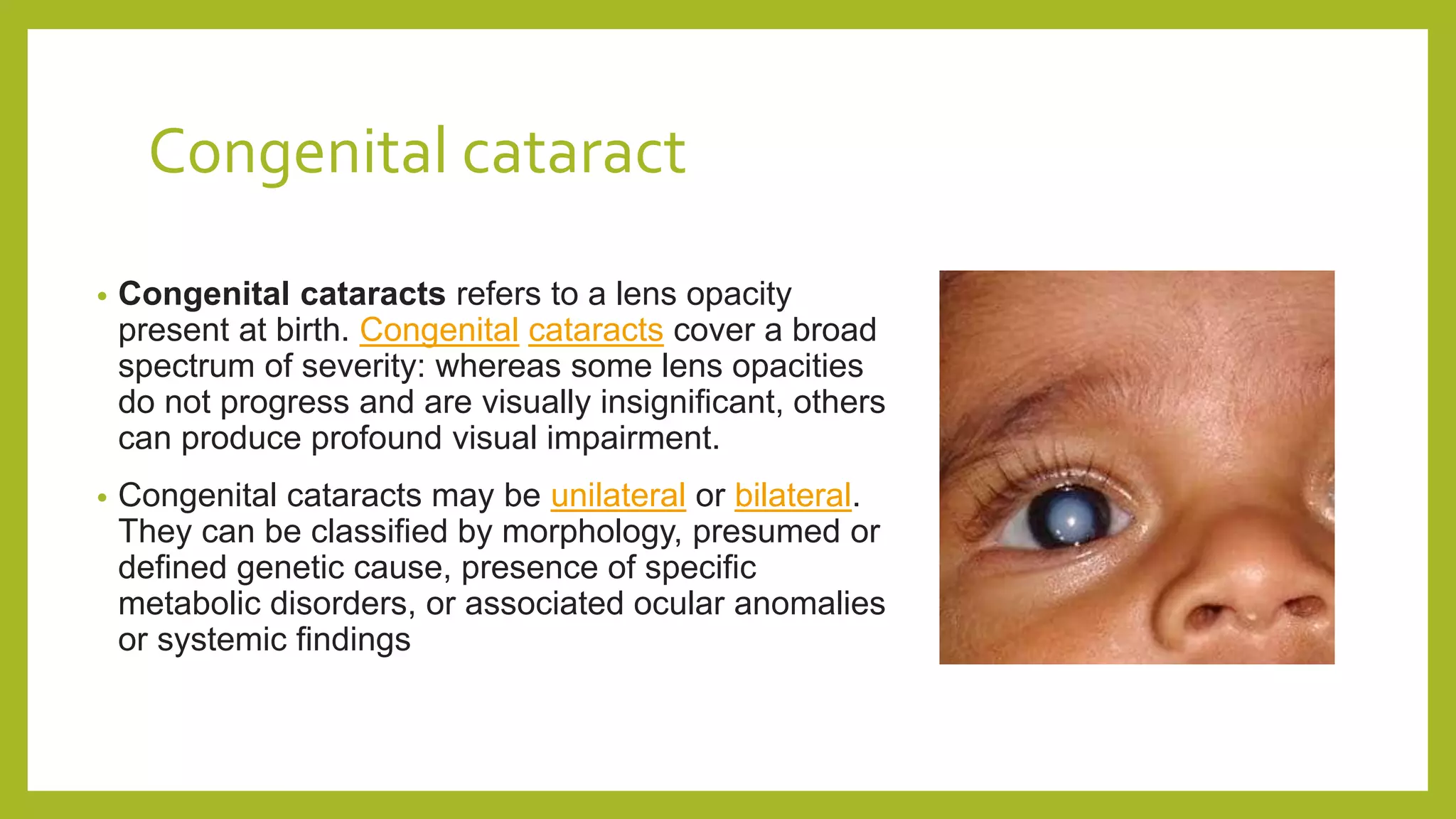 Clinical classification of cataracts : Mehedi , Jr. Optometrist | PPTX