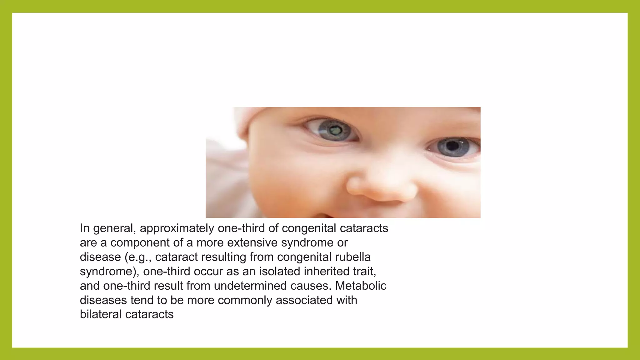 Clinical classification of cataracts : Mehedi , Jr. Optometrist | PPTX
