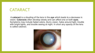 Clinical classification of cataracts : Mehedi , Jr. Optometrist | PPTX