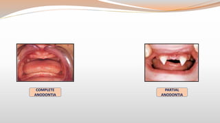 Clinical consideration in odontogenesis | PPTX