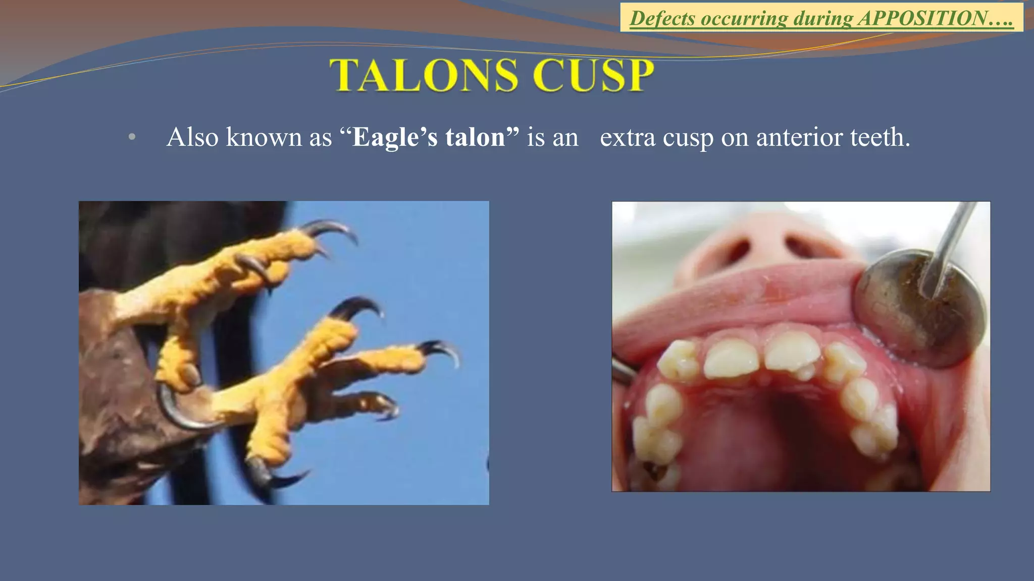 Clinical consideration in tooth development, eruption and shedding | PPTX
