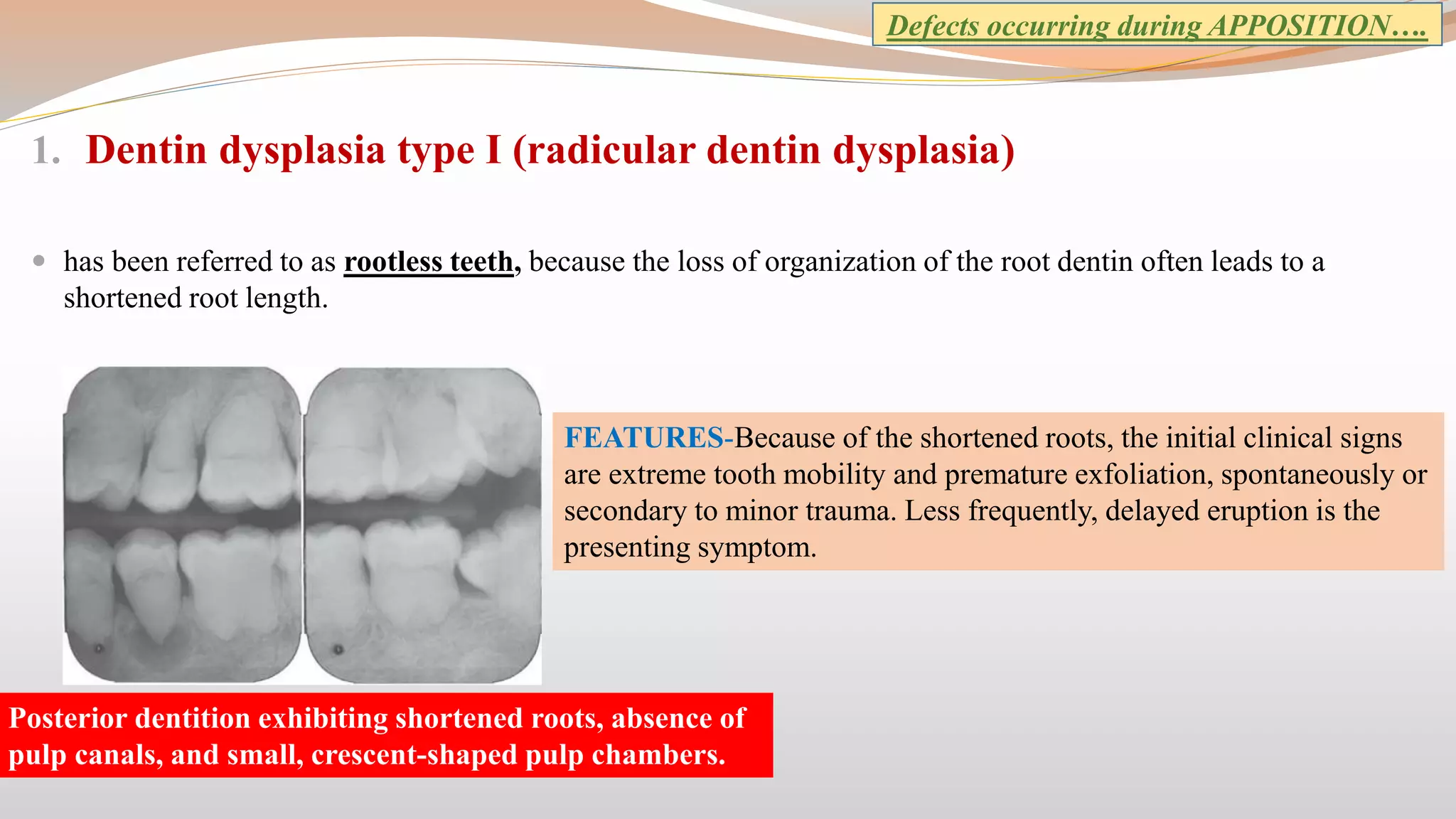 Clinical consideration in tooth development, eruption and shedding | PPTX