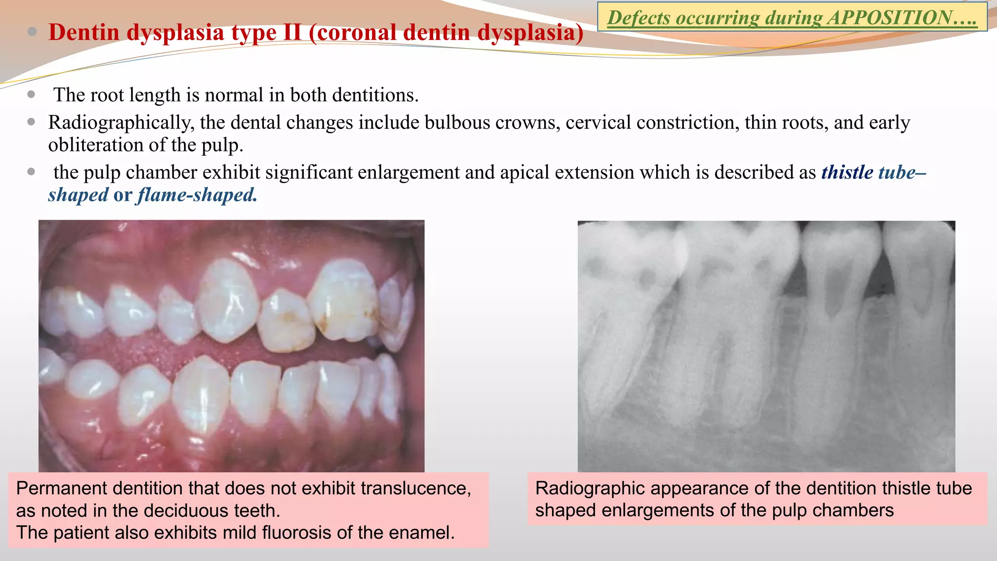Clinical consideration in tooth development, eruption and shedding | PPTX