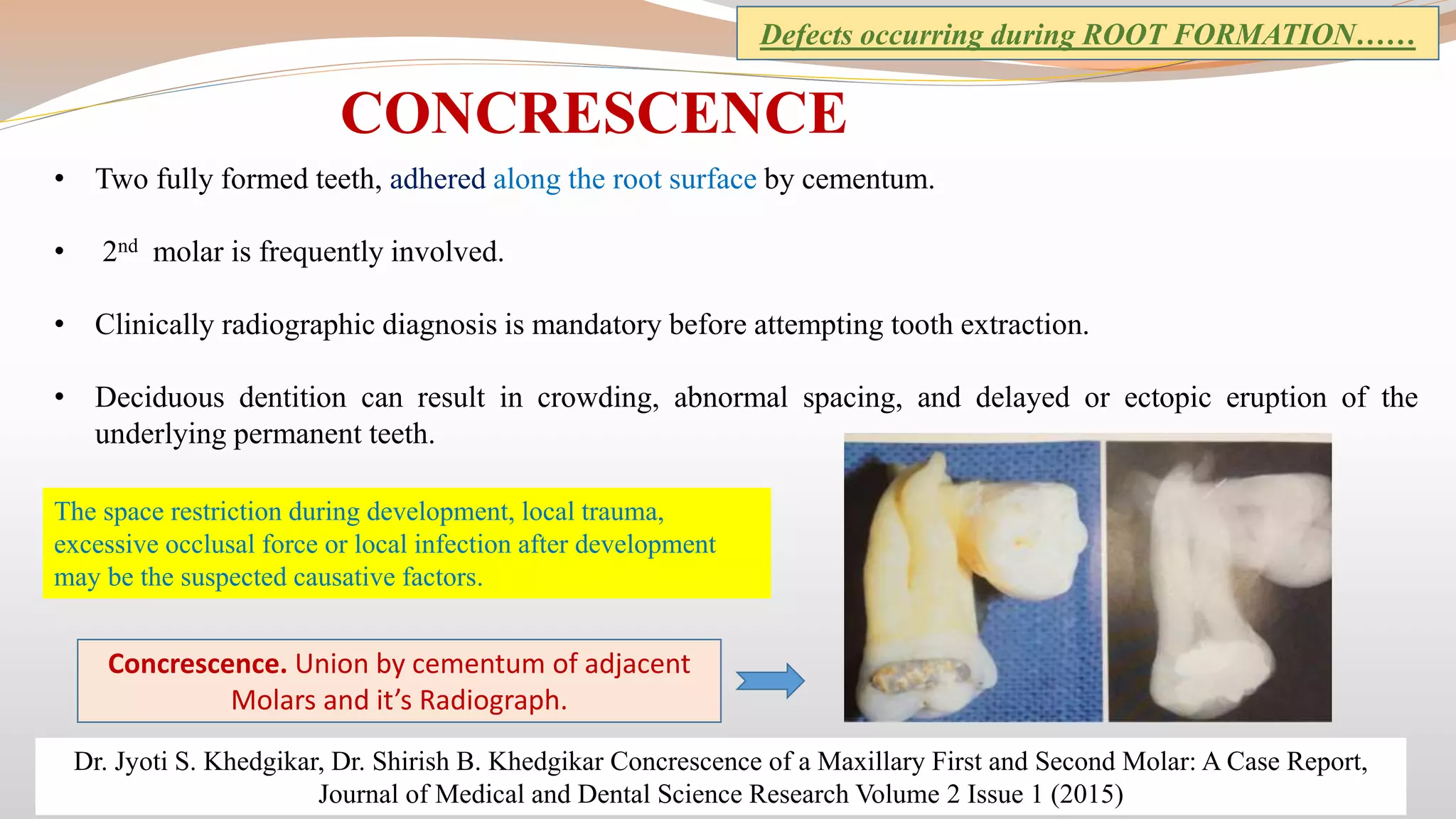 Clinical consideration in tooth development, eruption and shedding | PPTX